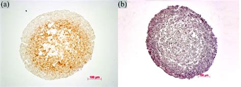 Melanoma Cell Line Spheroids Two Spheroids Of The Same Melanoma Cell