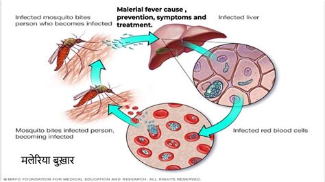 Malarial Fever Youtube