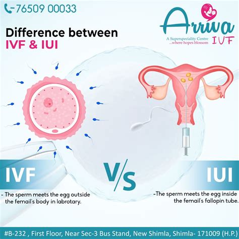 ☑️Both intrauterine insemination (IUI) and in vitro fertilization (IVF) are fertility treatments ...