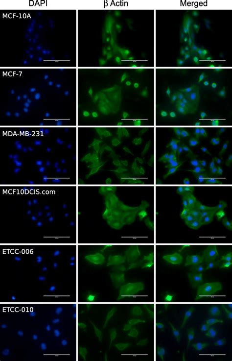 Cell Morphologies Of Dcis Cell Lines Etcc 006 And