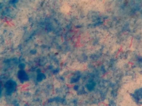 Mycobacterium Detection Object Detection Dataset By Fids