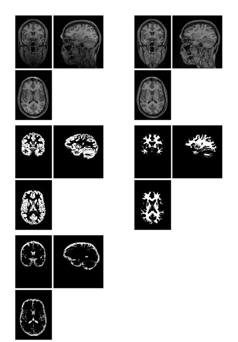 GitHub FarkadAdnan Statistical Parametric Mapping The FIL Methods Group