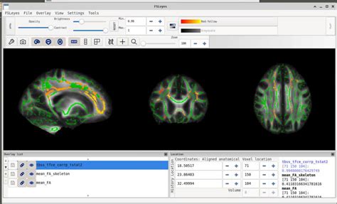 Diffusion Tensor Fitting And Tract Based Spatial Statistics Mri On Bear
