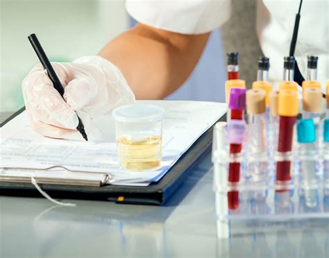 Urine Protein Dipstick Test