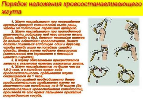 Через какое время ослабить жгут. Максимальное время наложения жгута ...