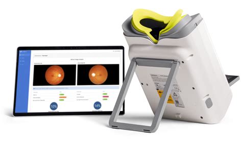 Ai Retinal Imaging For Early Disease Detection Optain Health