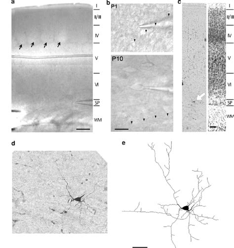 Identification And Labeling Of Cortical Subplate Neurons The Subplate Download Scientific
