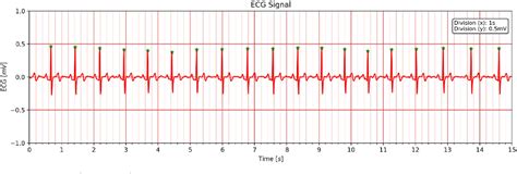 figure 3 from classification of ecg signal using fft based improved