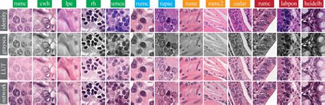 Quantifying The Effects Of Data Augmentation And Stain Color Normalization In Convolutional