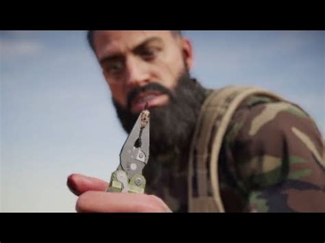Bullet Removal YouTube