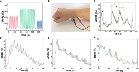 Respiratory And Pulse Signal Captured By P1 A Respiratory Signal