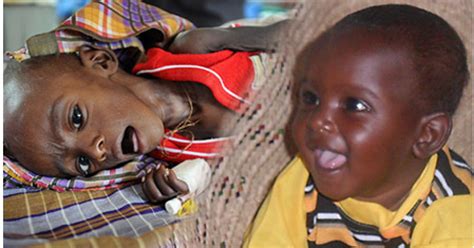 아프리카 기아 아기의 사진 감동