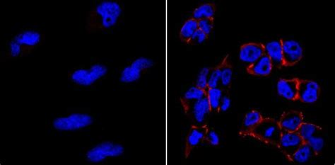 Tra 1 81 Monoclonal Antibody Tra 1 81 Dylight 550 Invitrogen 100 μl
