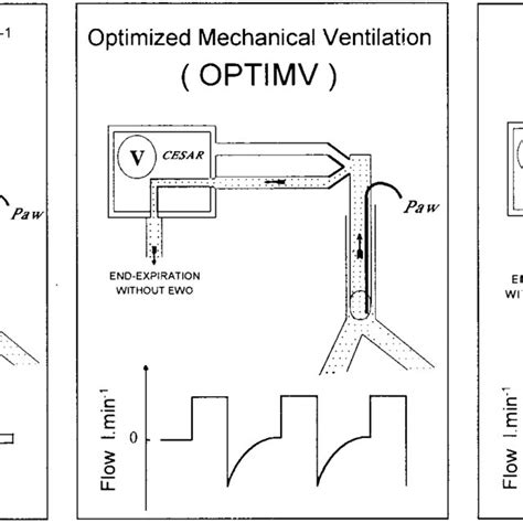 Chronology Of Controversy Surrounding Ardsnet Ventilator Trial