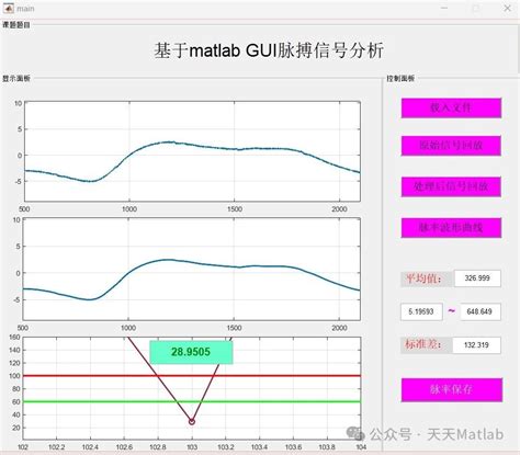 【肌电信号】基于低通滤波器实现脉搏信号分析emg 脉率 附matlab代码 肌电emg测量电路 csdn博客