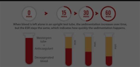Why Does Esr Decrease With Increased Rbc Count Rhematology