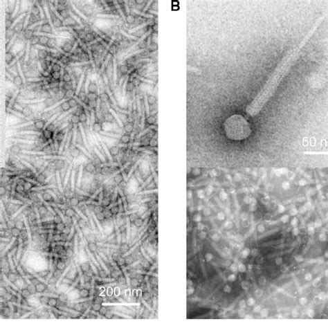 Transmission Electron Micrographs Of Defective Phage Pbp180 A And
