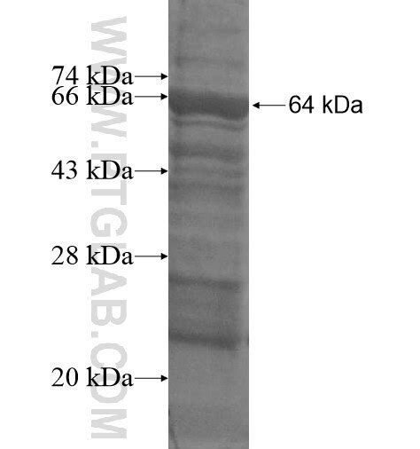 Mthfr Fusion Protein Ag14970 Proteintech