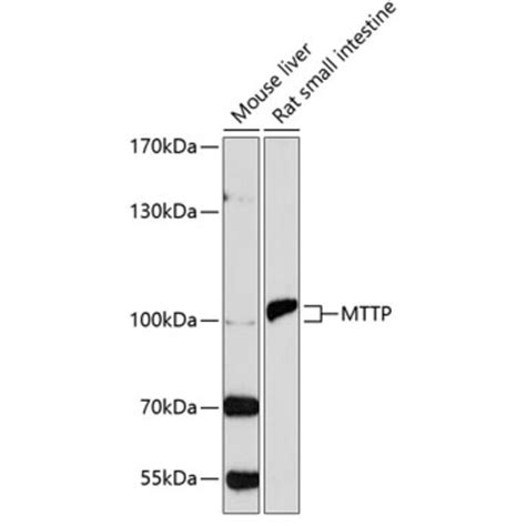 Anti Mttp Mtp Antibody A13631