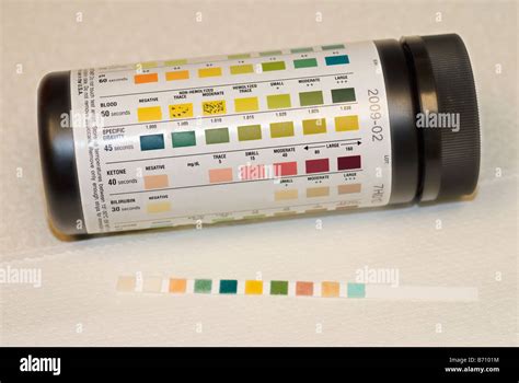 Urinary Tract Infection Dipstick At Erika Nelson Blog