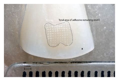 Photograph For Analysis Of The Total Area Of Adhesive Bonded To The Download Scientific Diagram