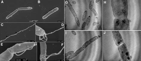 Electron Microscopy Of Wt H Pylori Strain X47 2al A B And Its