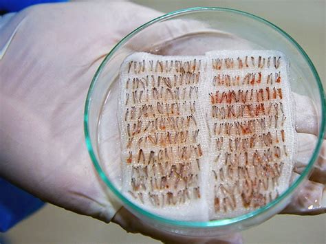 Worlds Thickest Hair Follicle