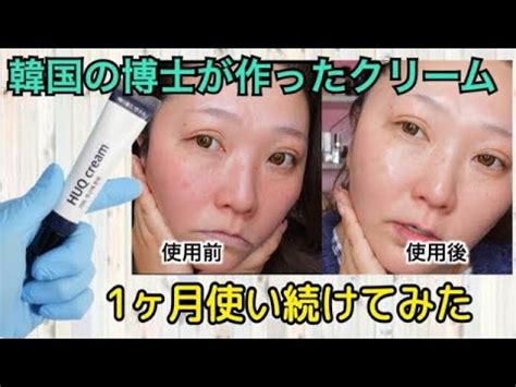 【韓国のシミ用クリーム】1ヶ月使い続けたら、こんなことになった！ Youtube