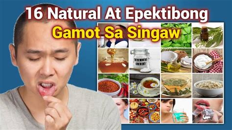 16 Natural At Epektibong Gamot Sa Singaw Canker Sore Mouth Sore