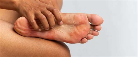 Why Does My Foot Have Red Spots Warning Signs That Require Emergency
