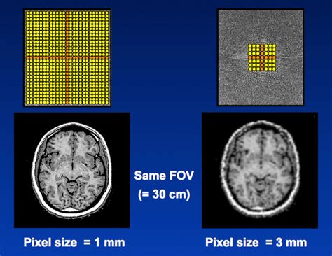 K Space Fov Questions And Answers In Mri
