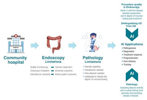 Artificial Intelligence In Inflammatory Bowel Disease Implications For Clinical Practice And