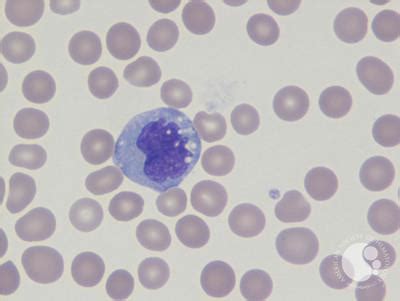 Stomatocytes