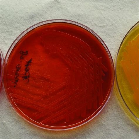 Pdf Simultaneous Isolation Of Chryseobacterium Gleum From Bloodstream