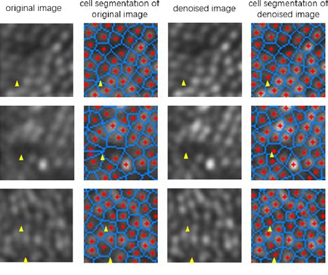 Figure 8 From Semi Supervised Generative Adversarial Learning For Denoising Adaptive Optics