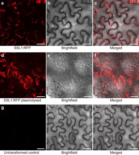 Transient Expression And Subcellular Localization Of E6l1rfp In N