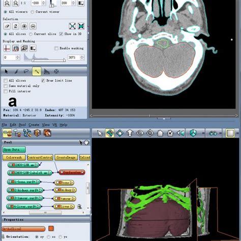 Examples Of The Segmentation And Reconstruction Process A Data Download Scientific Diagram