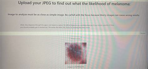 Photo · Issue 5 · Yasmine01545skin Cancer Diseases Classification