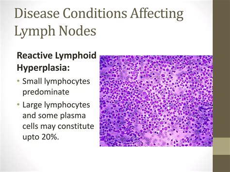 Lymph Node Impression Smear Cytology Pptx Cancer Diseases And