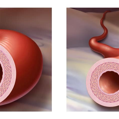 Illustration Gallery Geras Healthcare Productions