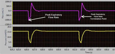 Fremitus T Low Aprv Initial Settings