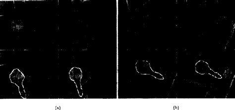 Generalised Hough Transform Semantic Scholar
