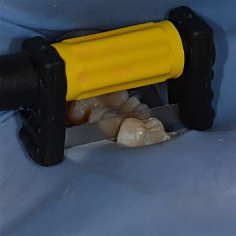 Fitstrip Starter Kit Optident Specialist Dental Products And Courses