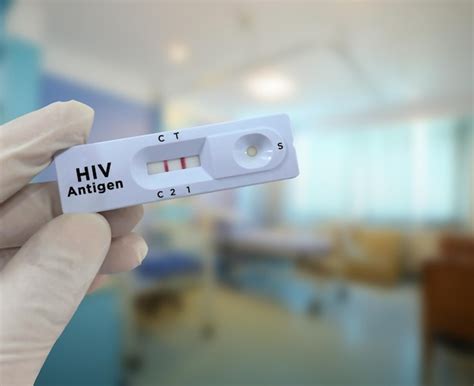 premium photo doctor hold hiv antigen positive test result rapid test