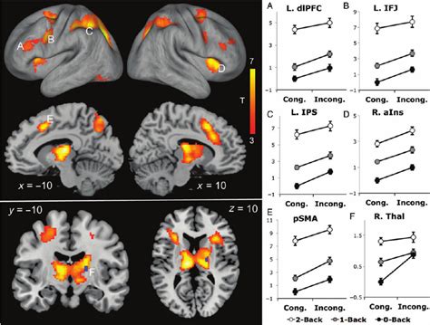 Functional Activation Results Left Statistical T Map Representing Download Scientific