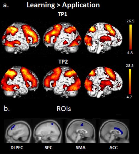 A Whole Brain Analyses Showing Comparable Neural Activation Patterns At Download Scientific