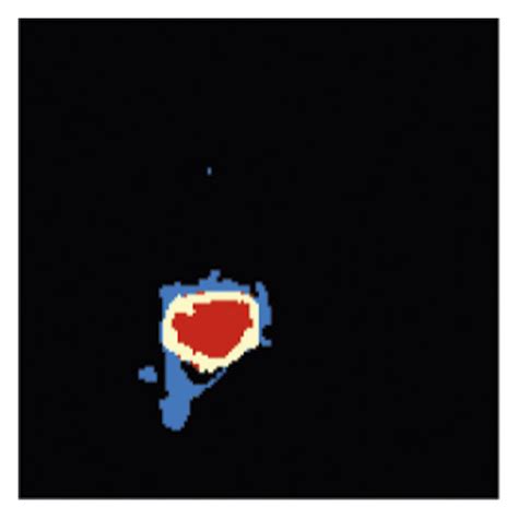 Case 1 Weak Contrast Between Light And Dark Inside The Image And Download Scientific Diagram