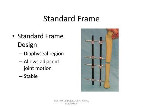 Principles Of External Fixator Ppt
