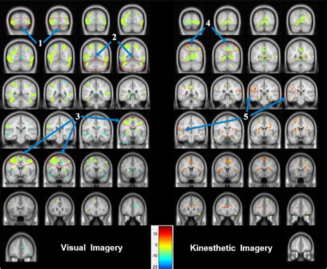 Areas Of Brain Activation For Visual Motor Imagery And Kinesthetic