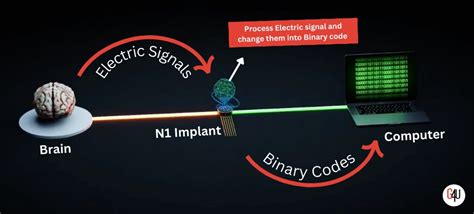 Neuralink Brain Chip Details And Working With Pros Cons